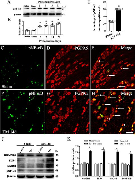 Endometriosis Upregulated Neuronal Pnf κb P65 In The Dorsal Root