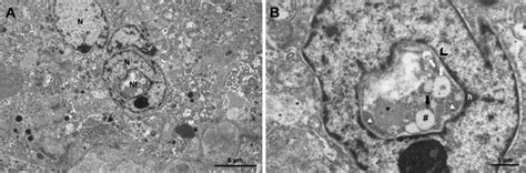 Ultrastructural Analysis Of Intranuclear Inclusions Ni In