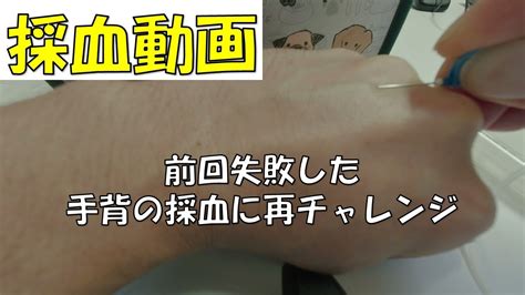 【採血動画】前回失敗した手背の採血に再チャレンジ【採血のコツ】弾力のある手背の血管ではどうやって採血ができるのか検証 Youtube