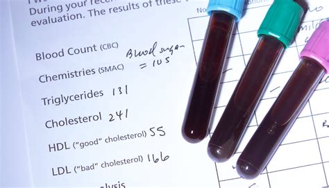 Good Cholesterol Has Links To Infectious Disease Futurity