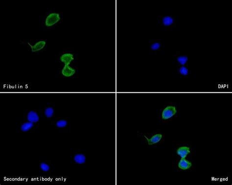 Fibulin 5 Monoclonal Antibody A1c12 Invitrogen 100 μl Unconjugated