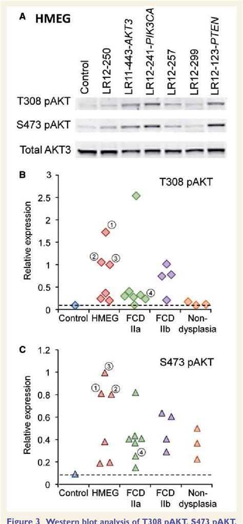 Figure 1 From Pi3kakt Pathway Mutations Cause A Spectrum Of Brain