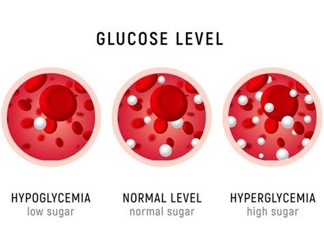 What Is Hyperglycemia