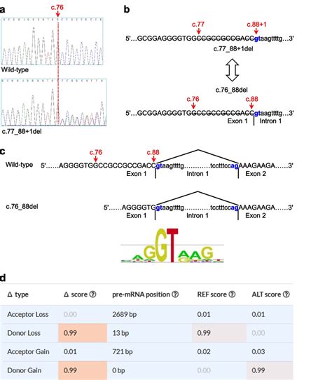 identification of a heterozygous 13 bp deletion in the lpl gene and in
