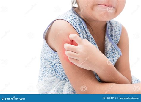Asian Girl Scratch The Itch With Hand Her Arm Because Of Mosquito Stock