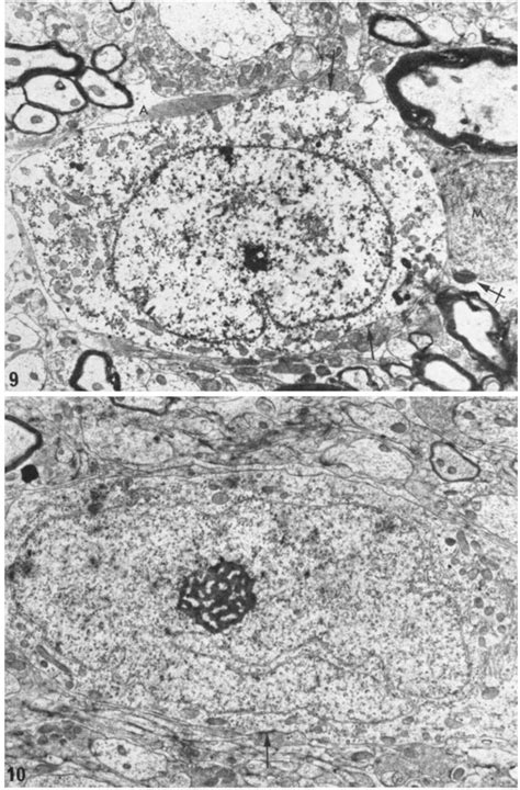 Chromatolyzed Neuron 14 Days After Nerve Crush Several Astrocytic Cell Download Scientific