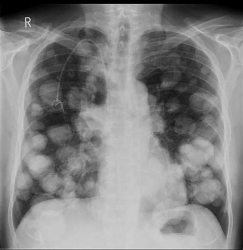 Pin On Bones And Xrays