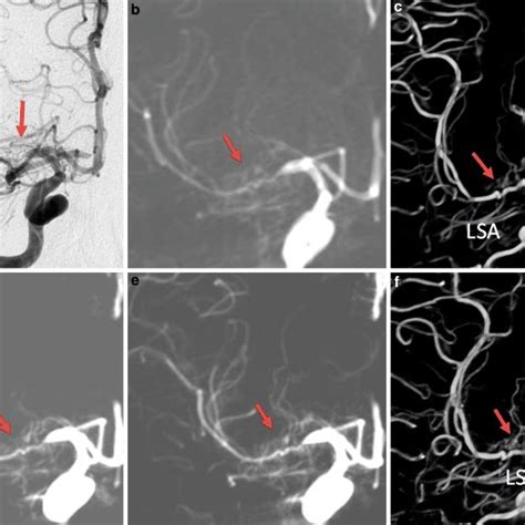 Comparison Between 2d Dsa 3d Dsa And 4d Dsa For Display Of Local Download Scientific Diagram