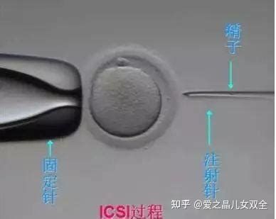 爱之晶为什么不是100 的卵子正常受精 知乎