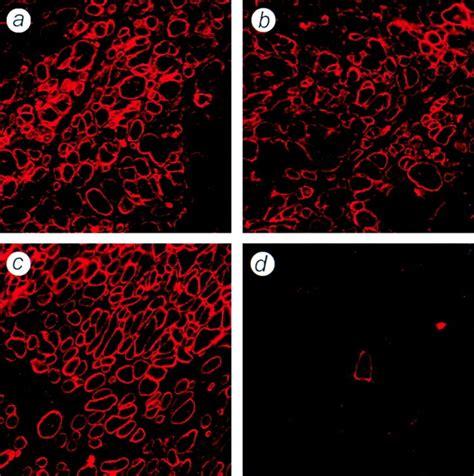 Dystrophin Expression In Sections Of Irradiated Mdx Muscles 3 Wk After