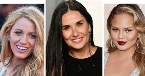 5 самых странных пластических операций которые делали звезды Marieclaire