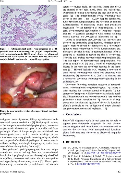 Lymphangioma