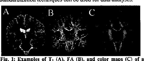 Figure 1 From Data Analysis Techniques And Applications Of Diffusion Tensor Imaging Semantic