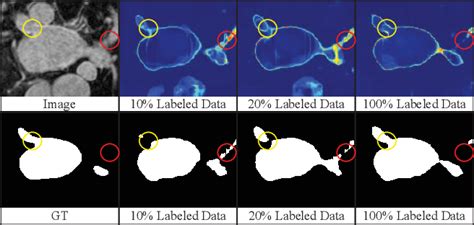 Figure 1 From Mutual Consistency Learning For Semi Supervised Medical