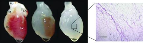 Comparison Of Methods For Whole Organ Decellularization In Tissue Engineering Of Bioartificial