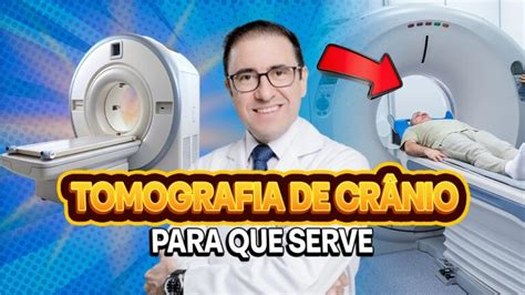 Tomografia Do Crânio Entenda O Processo E A Importância Actualizado