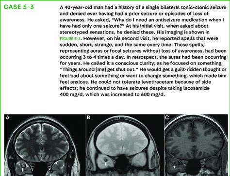 Imaging Of The Patient In Case 5 2 Showing A Right Temporal Polar