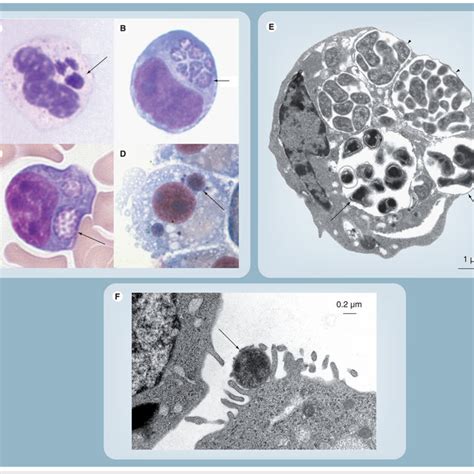 Number Of Human Monocytic Ehrlichiosis Ehrlichia Ewingii Ehrlichiosis Download Scientific