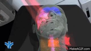 What To Expect During RapidArc Radiation Therapy On Make A