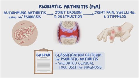 Psoriatic Arthritis Video And Meaning Osmosis
