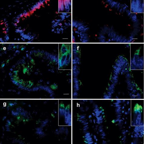 Localisation Of Proteins With Different Pka Dependent Phosphorylation