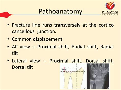 9 Forearm Lower End Fractures Ppt