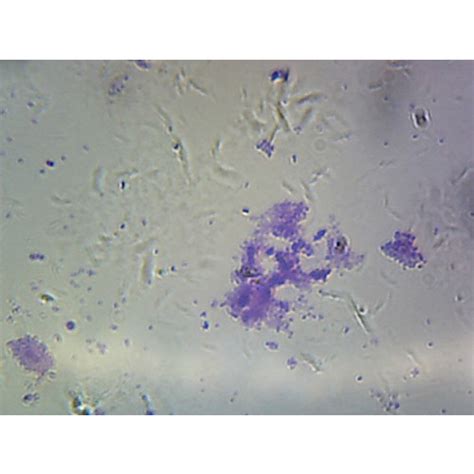 Prepared Microscope Slide Streptococcus Diplococcus Pneumonia