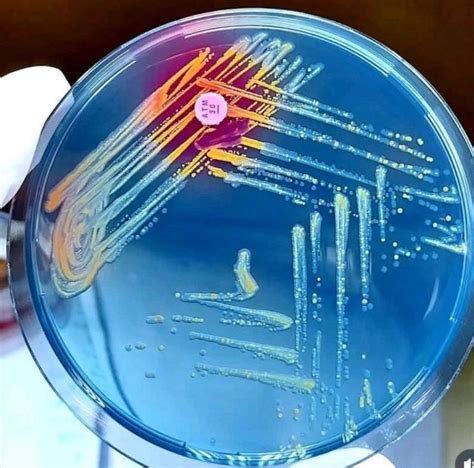 Why Use Cled Agar Cled Cystine Lactose Electrolyte Deficient Agar Is