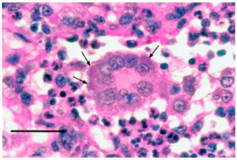 Y3 Loh Infectious Respiratory Disease In Cattle And Sheep Flashcards