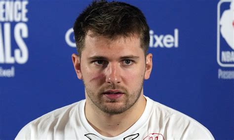 Luka Doncic On His Game 1 Scar ‘makes Me Look Tough