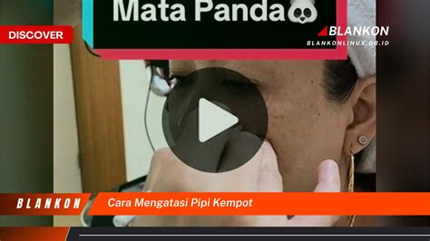 Temukan Cara Mengatasi Pipi Kempot Yang Jarang Diketahui