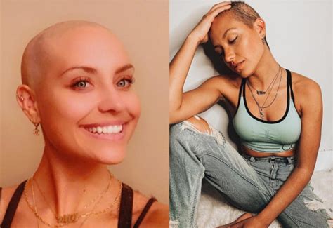 Girl Shaved Her Head To Show She Is Still Gorgeous In Spite Of Her Bald
