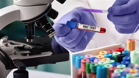 ما هو تحليل Hematocrit Test اختبار الهيماتوكريتhct؟