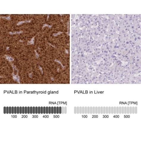Parvalbumin Antibody Novus Biologicals 01ml Unlabeledantibodies