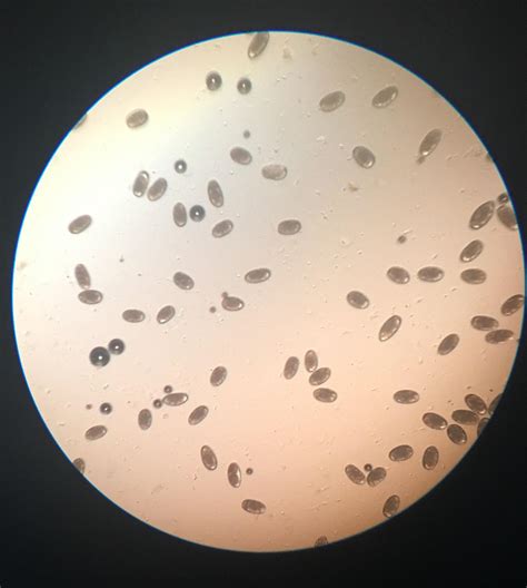 Fecal Float From A Deceased Goat R Vettech