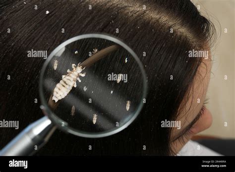 Pediculosis Woman With Lice And Nits Closeup View Through Magnifying