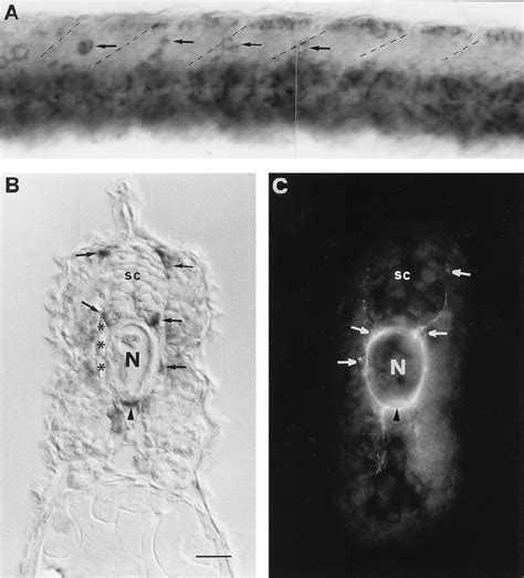 Distribution Of Tn C Mrna By In Situ Hybridization In Trunk Neural Download Scientific Diagram