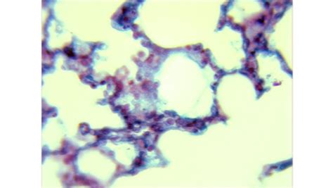 Solved From The Lung Simple Squamous Recognize Slide At