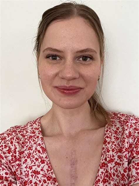 Georgie Cauchi Battling Bowel Cancer After Multiple Heart Surgeries The Advertiser