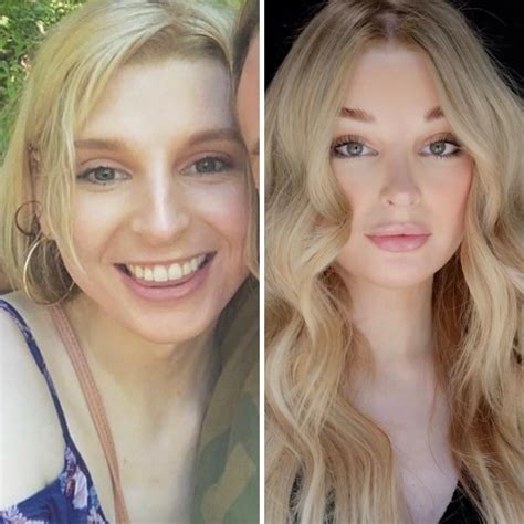 Mtf 29 Vs 37 At 20 Months Hrt Rtranstimelines