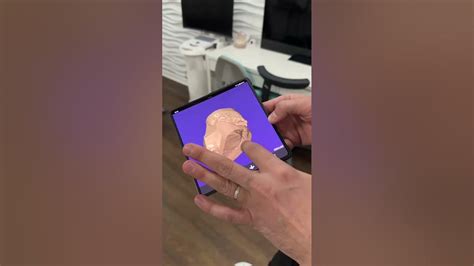 Цифровая стоматология 3d при планировании лечения зубы улыбка Youtube