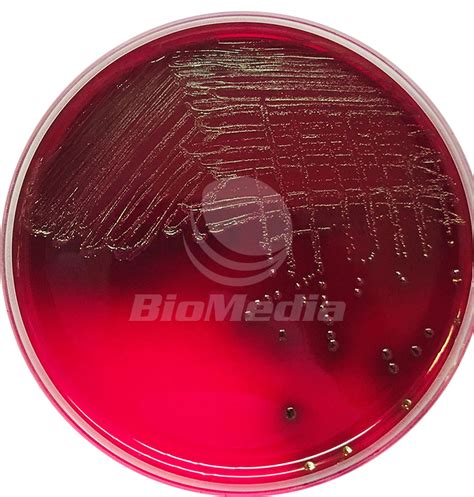 Агар Эндо (Endo Agar) - готовая питательная среда от Biomedia
