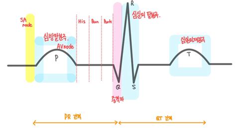 [ecg 기초정리 4 ] 심전도 Qrs파의 형성 병적q파 Pathologic Q Wave 전기흐름의 방향 Qrs Duration