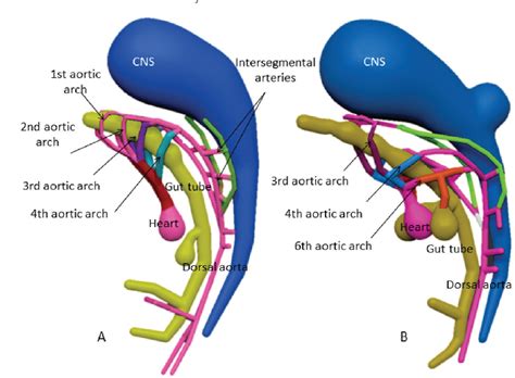 Figure 5 From Fetal Aortic Arch Anomalies Key Sonographic Views For