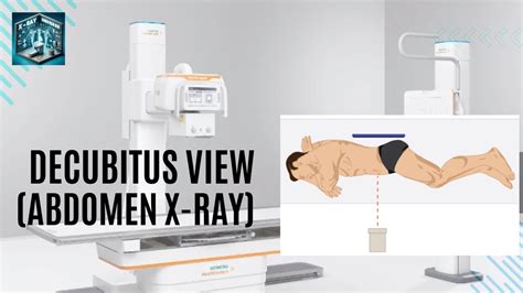 Abdomen Decubitus View Radiography Positioning Youtube