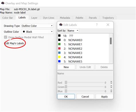 Seed Based Analysis Step 4 — Neurodocs 011 Documentation