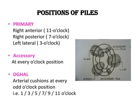 Ppt Management Of Haemorrhoids Piles Powerpoint Presentation Free