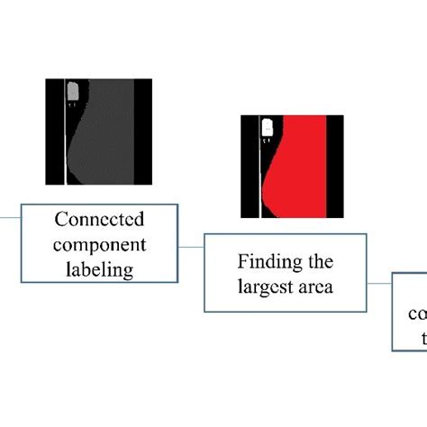 block diagram of removing artifacts from mammograms download