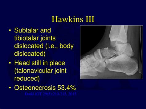 Talus Fractures Pat Yoon Md Hennepin County Medical Center Ppt Download