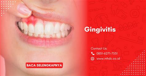 Gingivitis Adalah Penyebab Gejala Dan Cara Pencegahannya